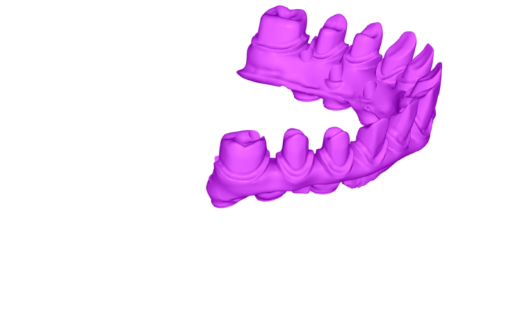 Panthera Fusion Bar | Panthera Dental